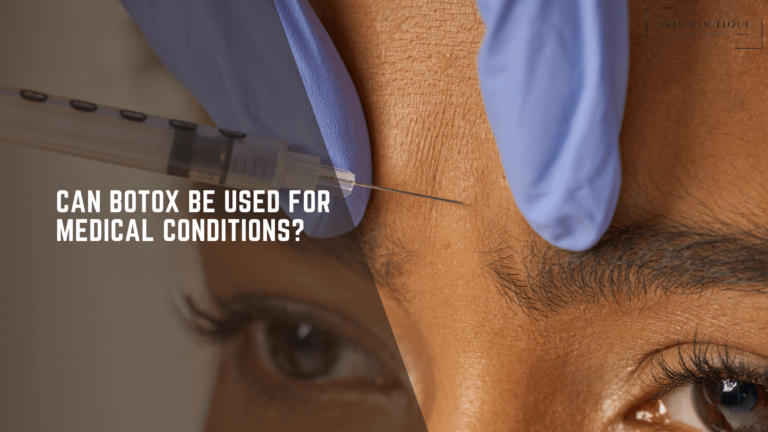 Can Botox Be Used For medical Conditions?